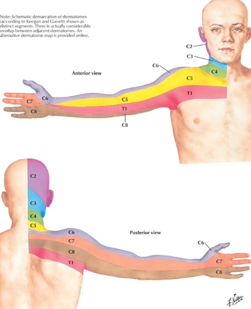 Cervical Radiculopathy Motus Physical Therapy Cervical Radiculopathy Motus Physical Therapy